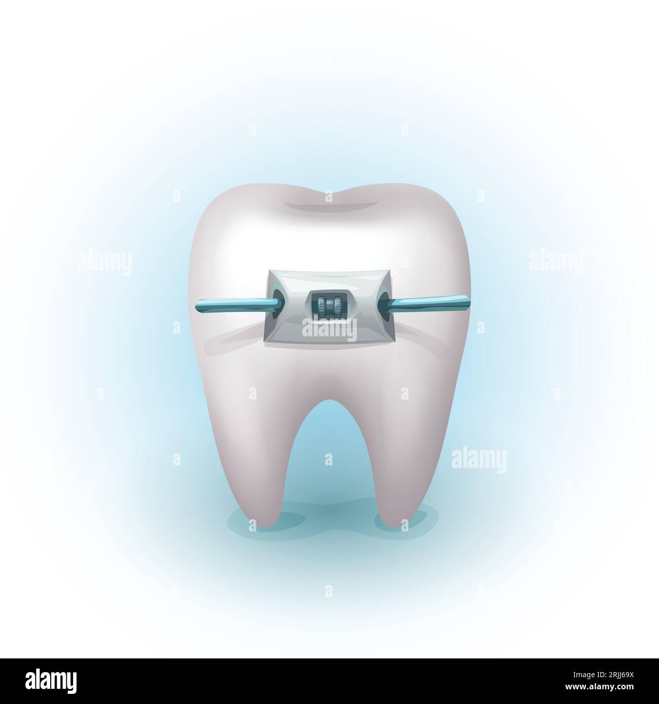 a realistic human white tooth with braces Stock Vector Image & Art - Alamy