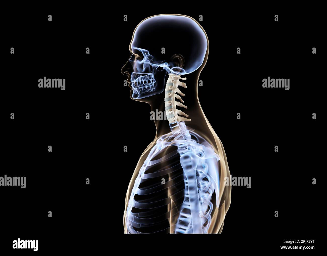 x-ray side view of cervical section of spine Stock Photo - Alamy