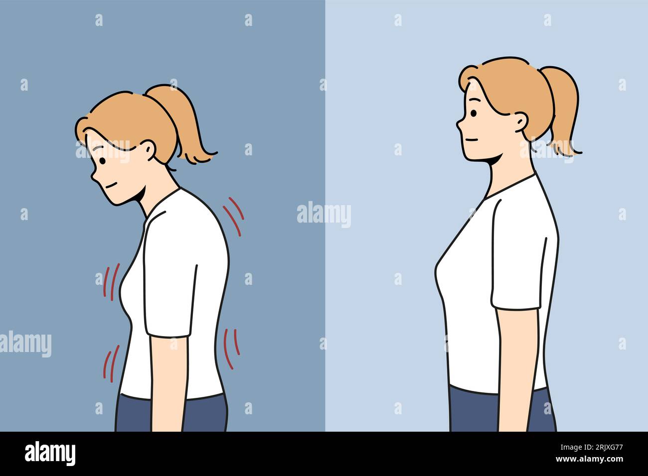 Stooped woman before and after correcting posture thanks to massage ...