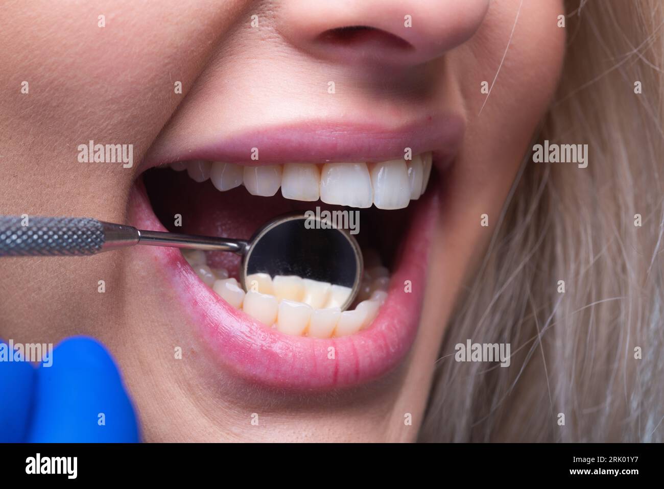 Examination of teeth with dental mirror. Dental and oral hygiene ...
