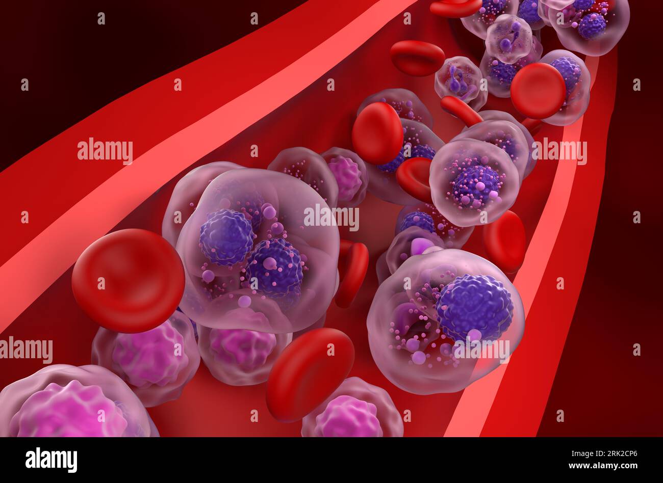 Multiple myeloma (MM) cells in the blood flow - closeup view 3d illustration Stock Photo - Alamy