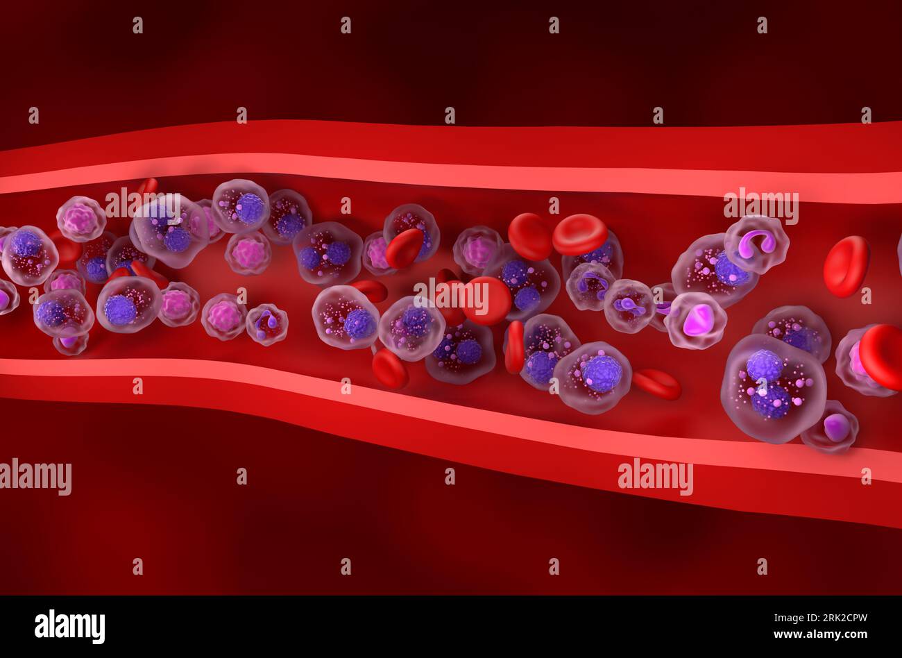 Multiple myeloma (MM) cells in the blood flow - isometric view 3d ...
