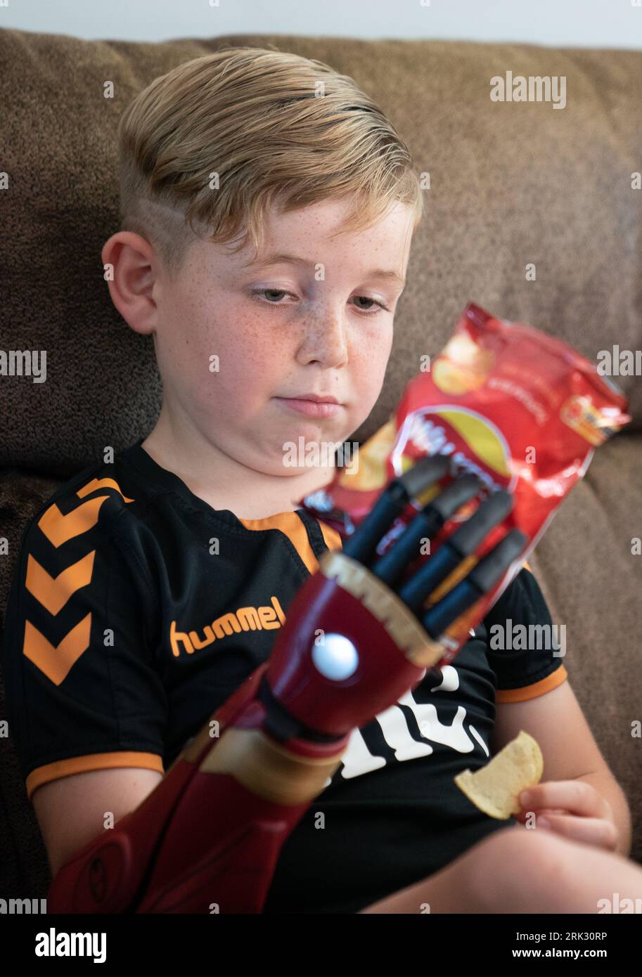 Louie Morgan-Kemp, seven, who was born without a right hand ...