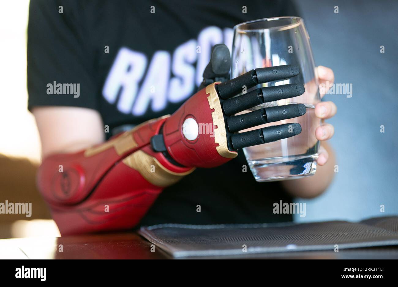 Louie Morgan-Kemp, seven, who was born without a right hand ...