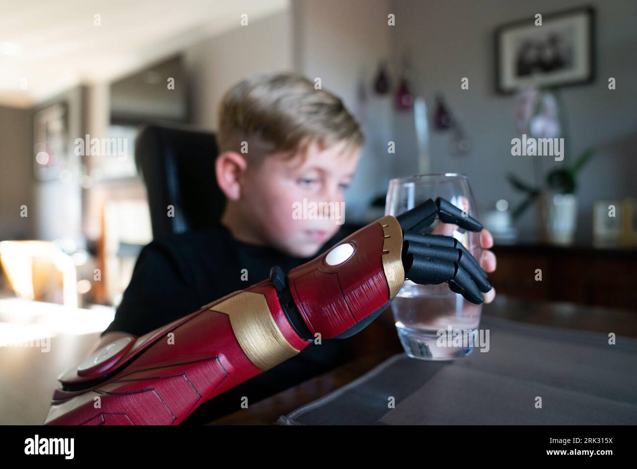 Louie Morgan-Kemp, seven, who was born without a right hand ...