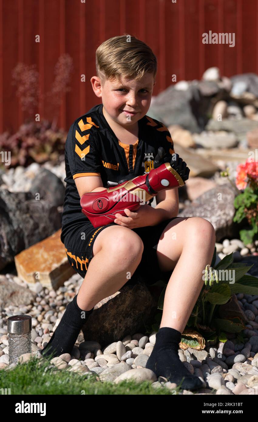 Louie Morgan-Kemp, seven, who was born without a right hand ...