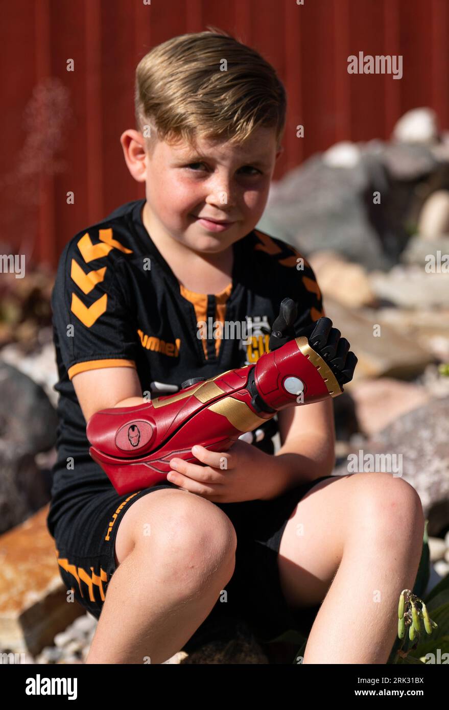 Louie Morgan-Kemp, seven, who was born without a right hand ...