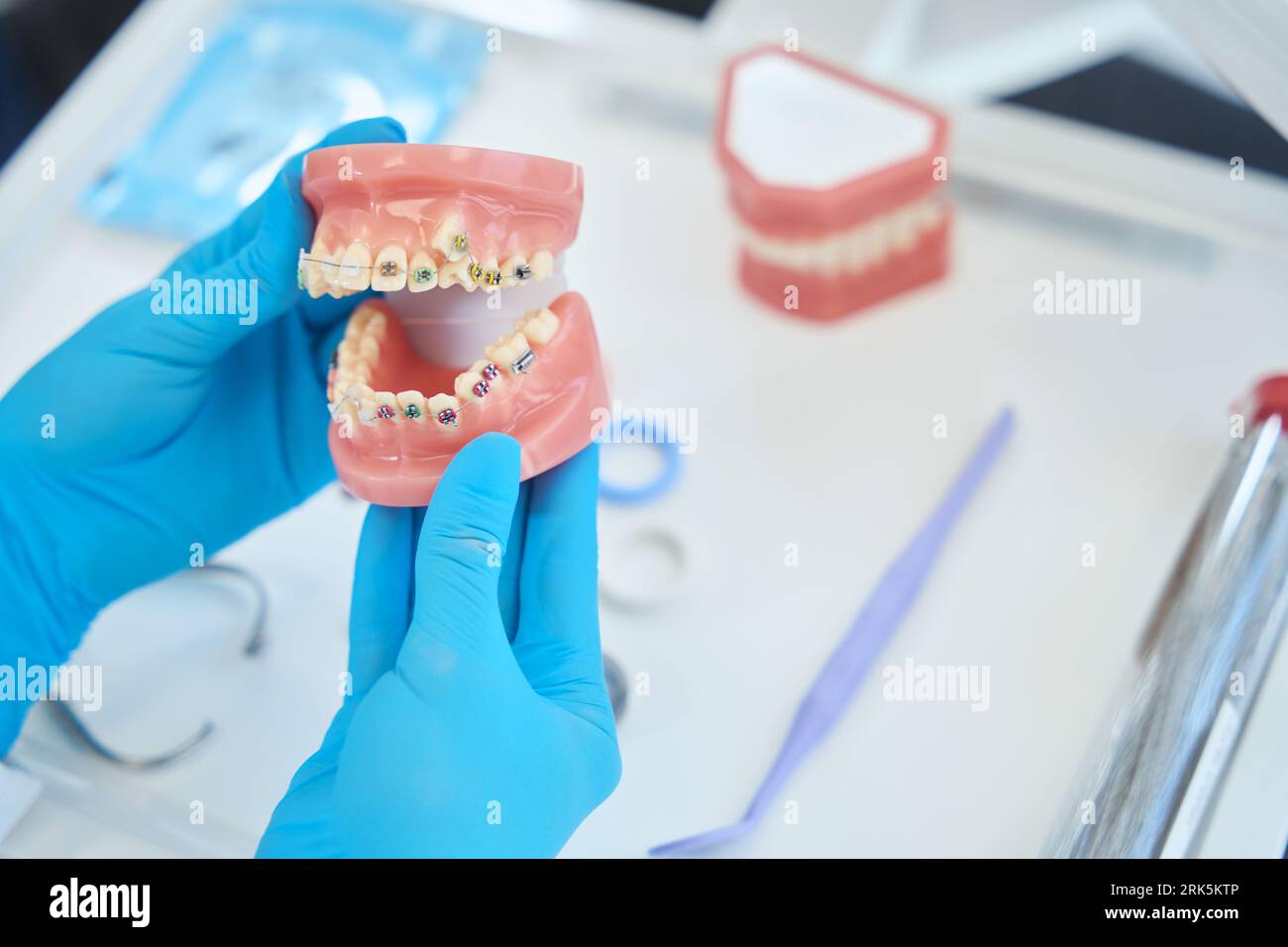 Close up photo of dentist holding jaw with braces Stock Photo - Alamy
