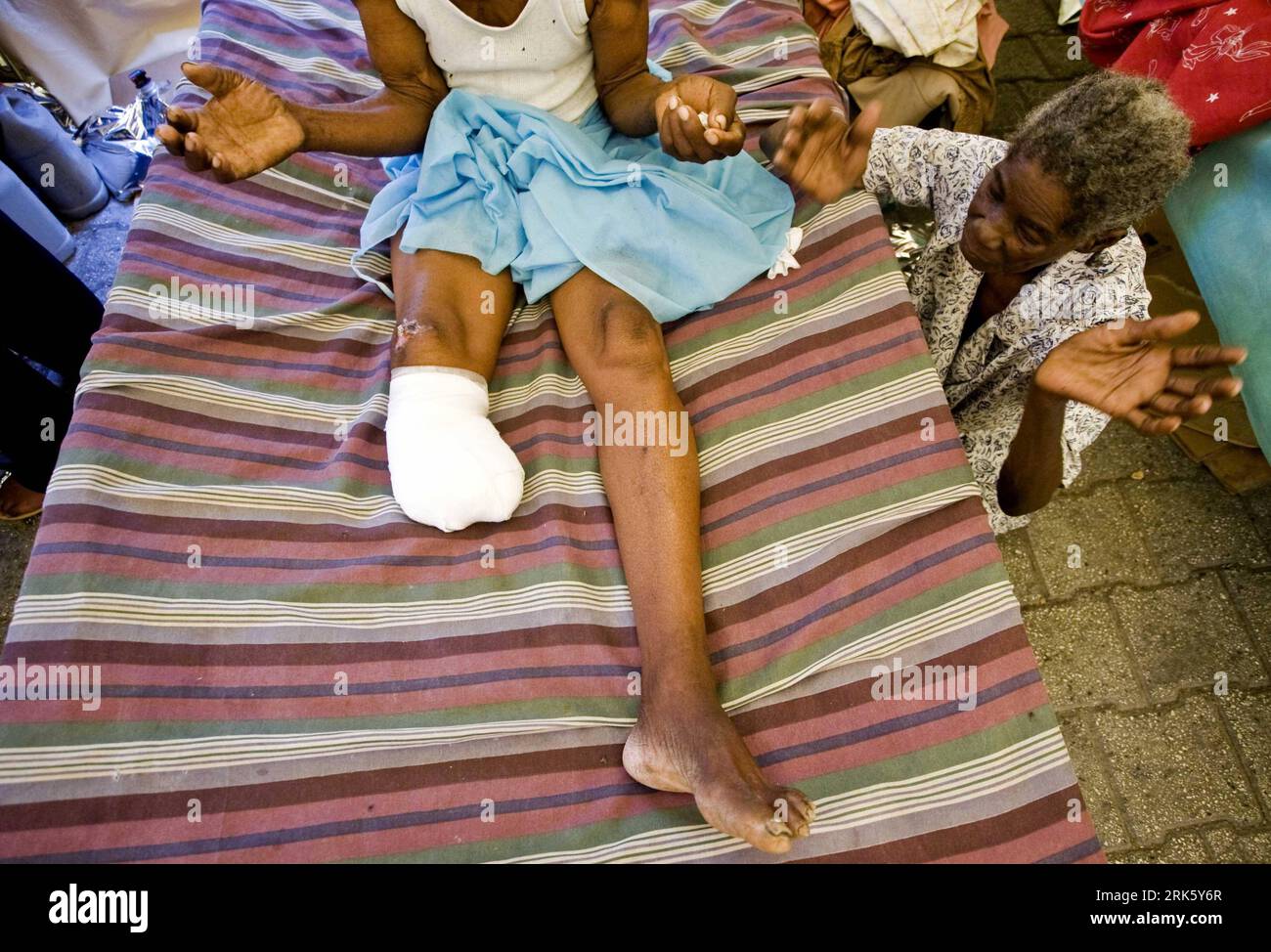 Leg amputation hospital hi-res stock photography and images - Alamy