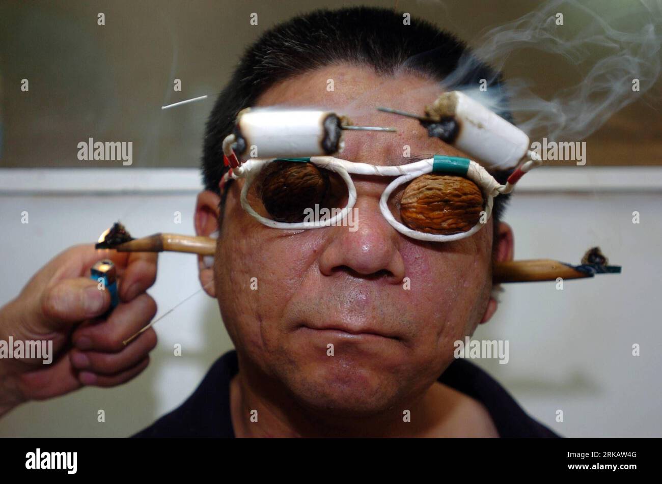 Medicine technique hi-res stock photography and images - Alamy