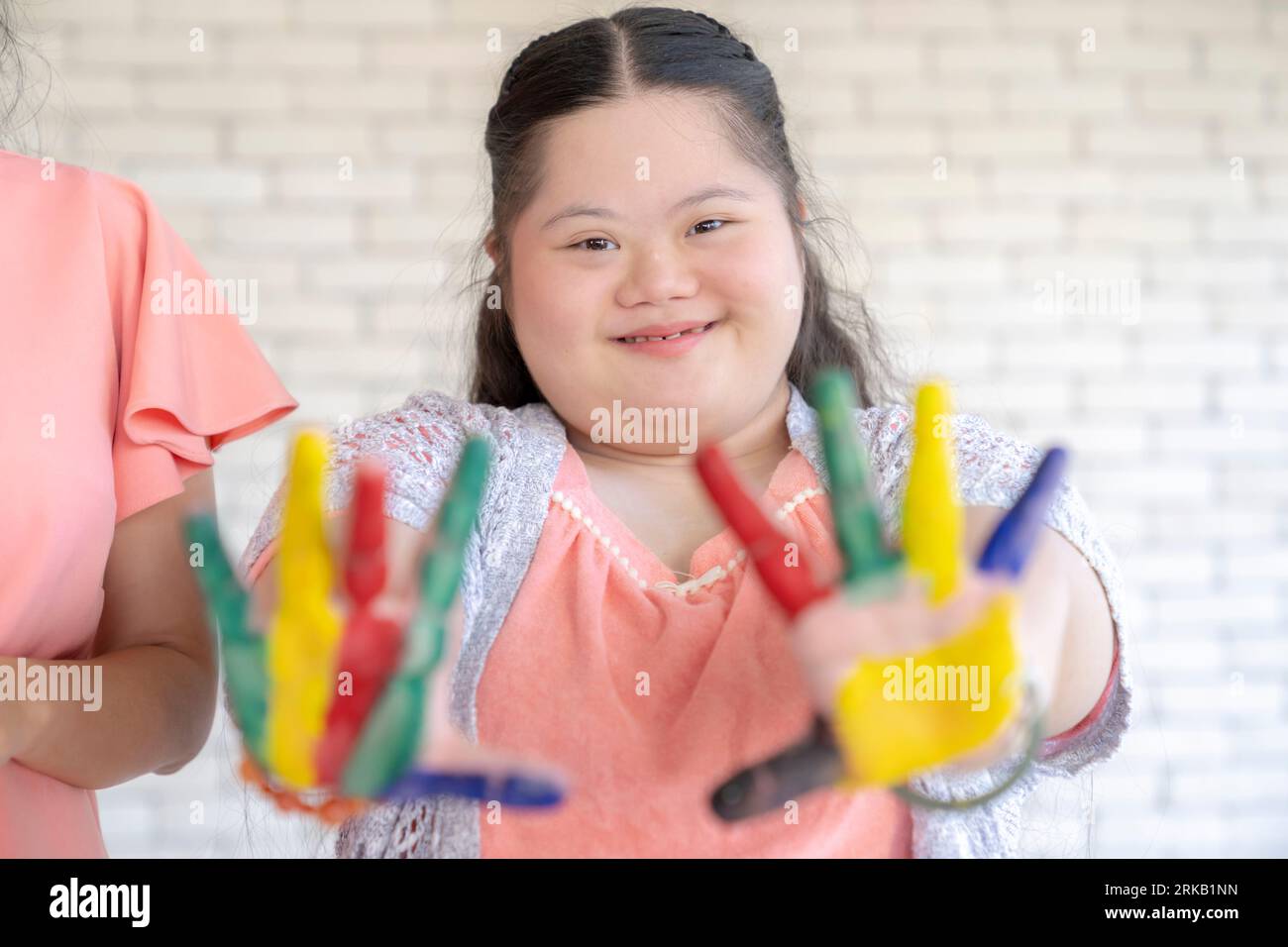 Down syndrome girl baby hi-res stock photography and images - Alamy