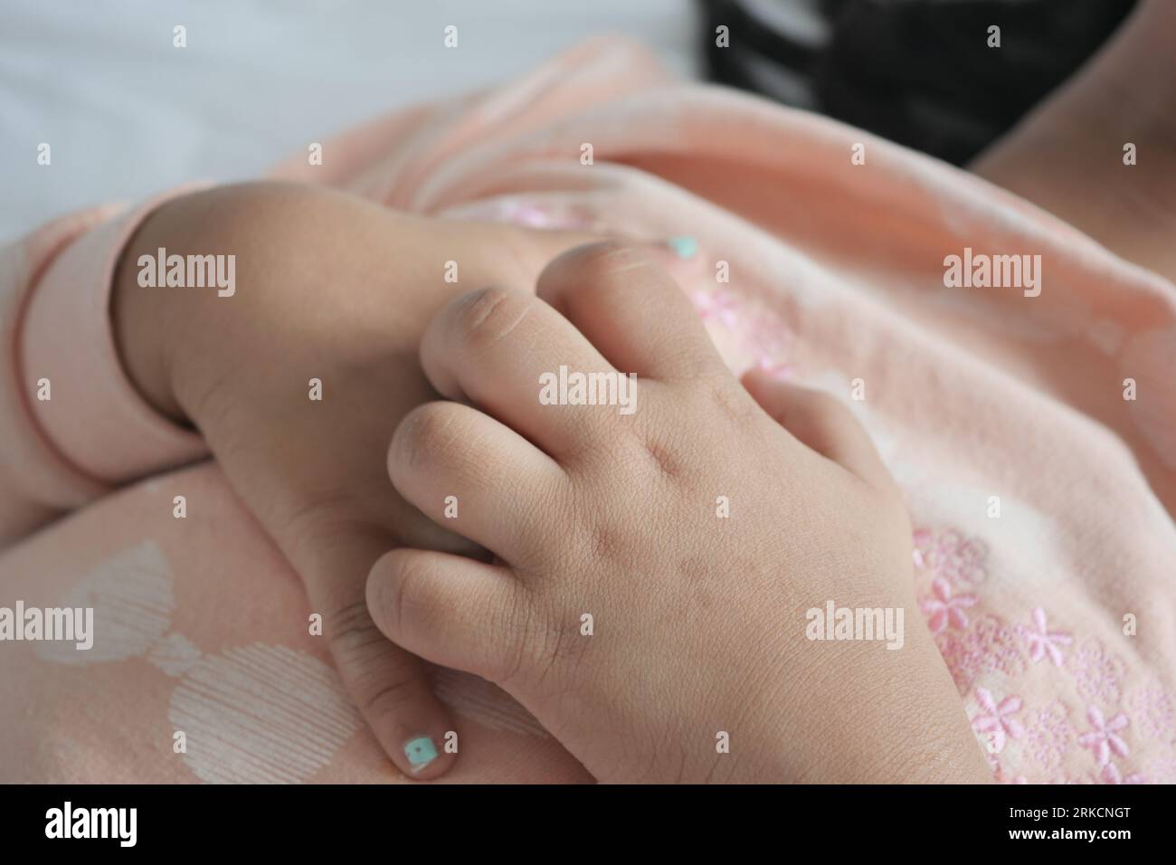 child girl suffering from itching skin on hand Stock Photo - Alamy
