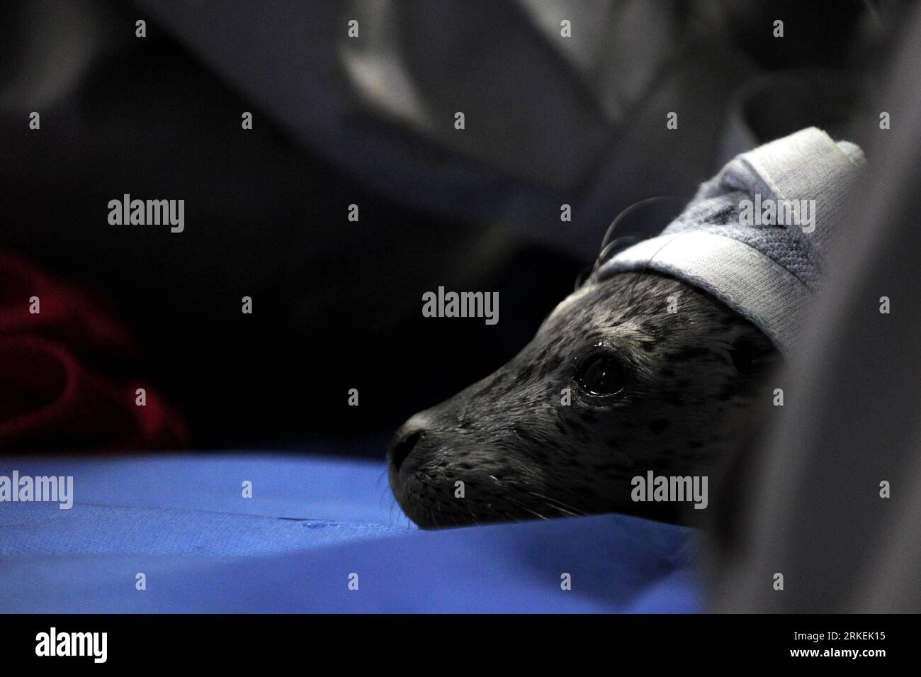 Limb amputations hi-res stock photography and images - Alamy