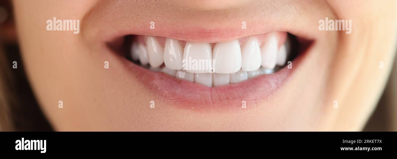 Close-up of female showing healthy smooth white teeth Stock Photo - Alamy