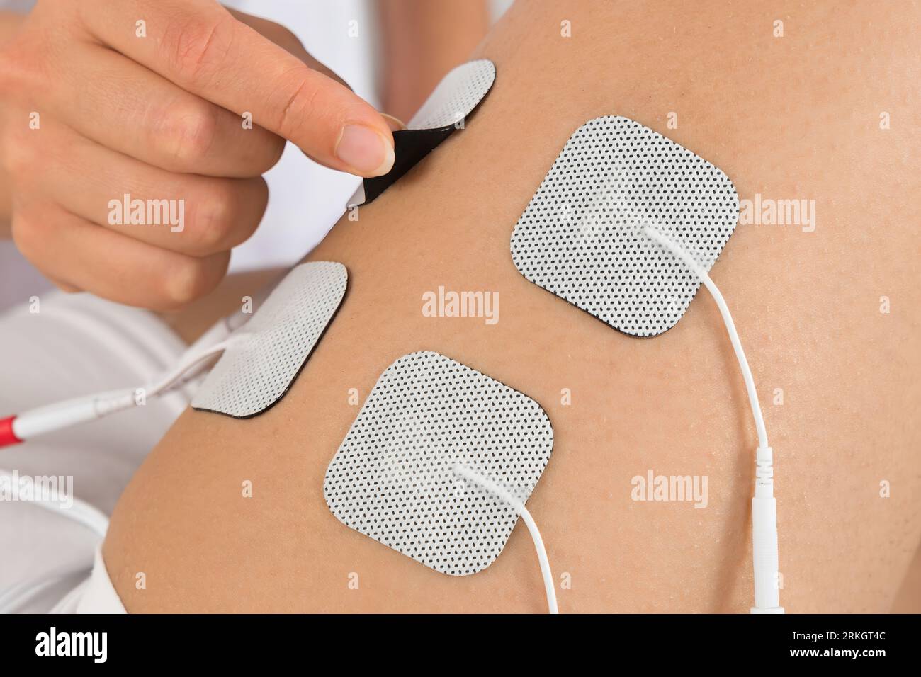 Close-up Of Therapist Placing Electrodes On Woman's Thigh Stock Photo ...