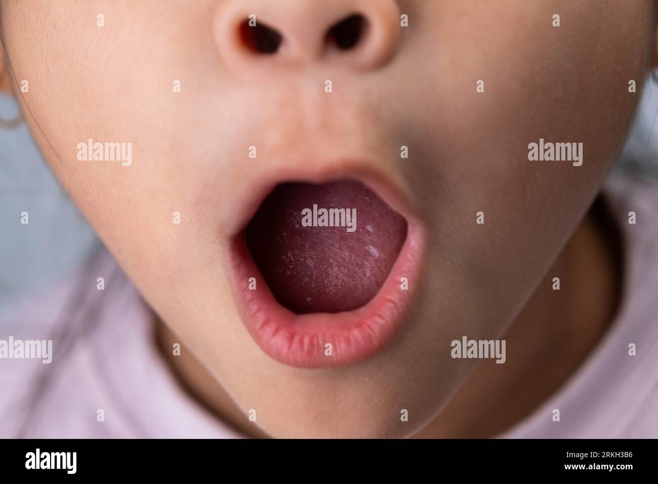 Preteen girl mouth open hi-res stock photography and images - Alamy