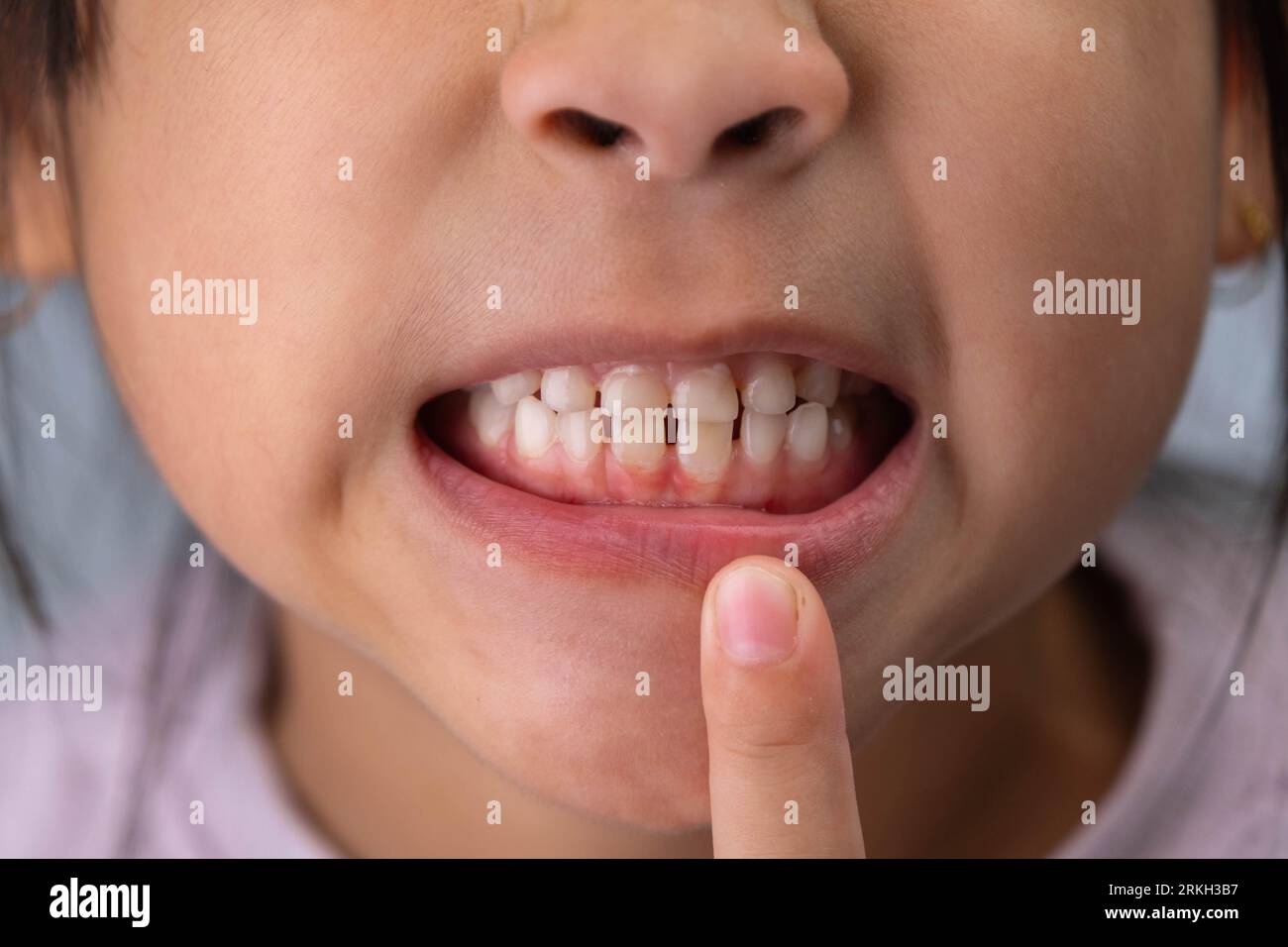 Headshot cropped image of cute preschool girl smiling wide showing milk ...