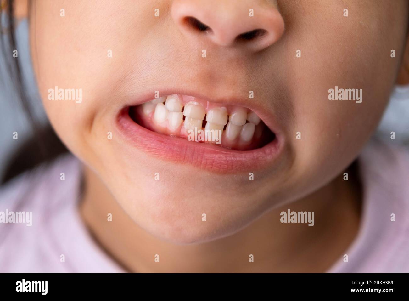 Headshot cropped image of cute preschool girl smiling wide showing milk ...