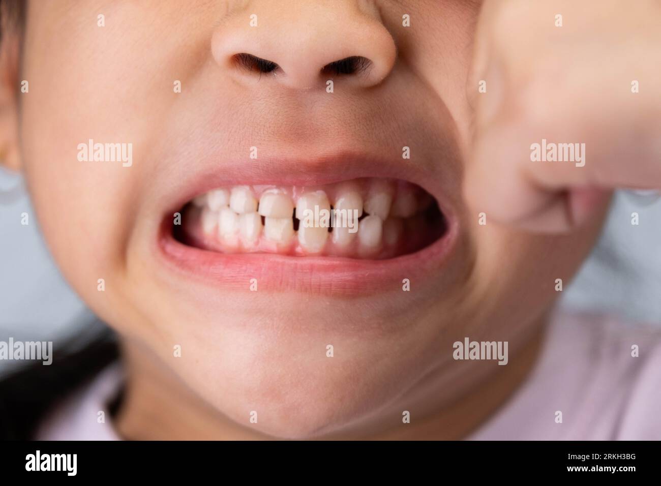 Headshot cropped image of cute preschool girl smiling wide showing milk ...
