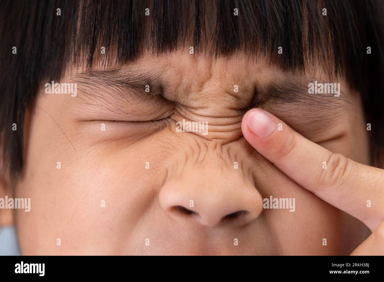 Little girl allergic to dust rubs her eyes close-up. Little girl itchy ...
