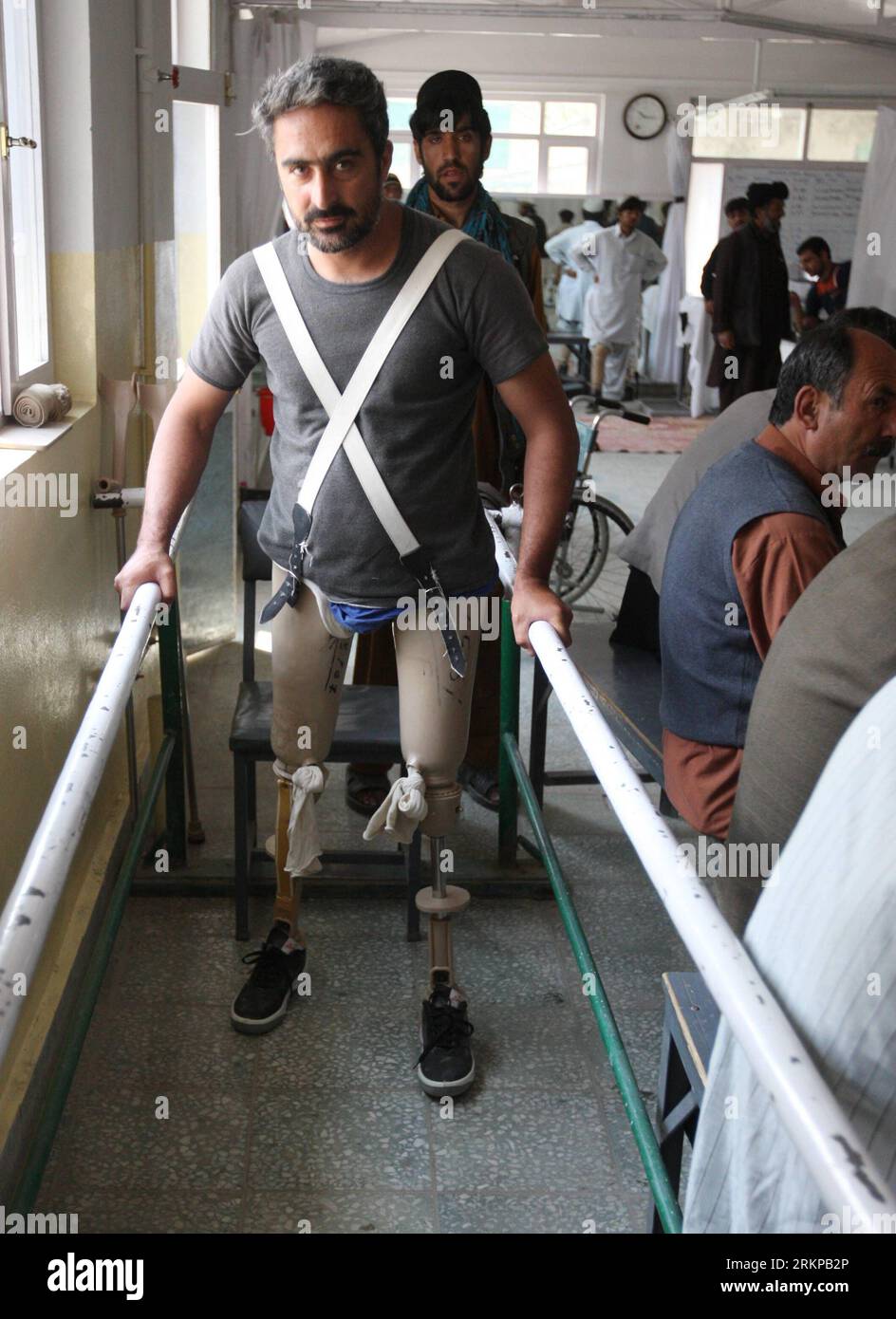 Amputa hi-res stock photography and images - Alamy