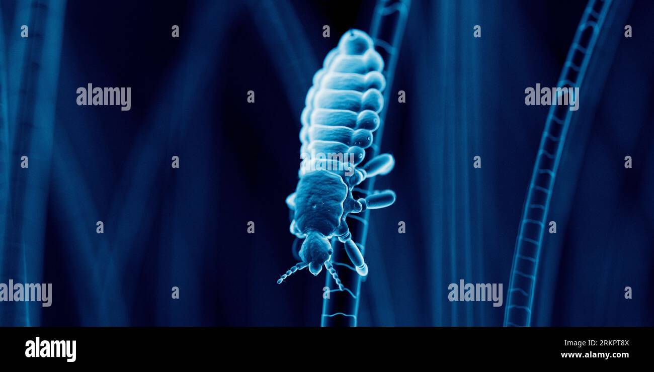 Head louse, illustration Stock Photo - Alamy