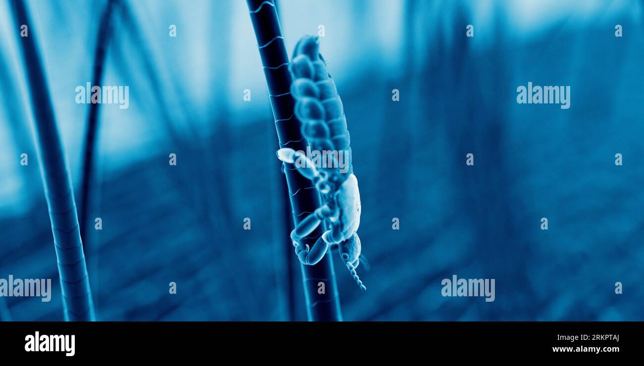 Head louse, illustration Stock Photo - Alamy