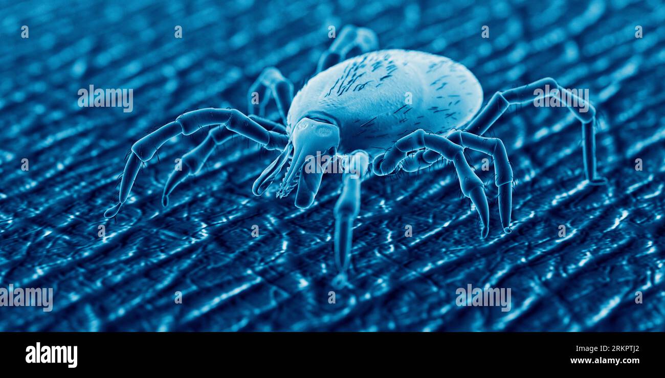 Tick on human skin, illustration Stock Photo - Alamy