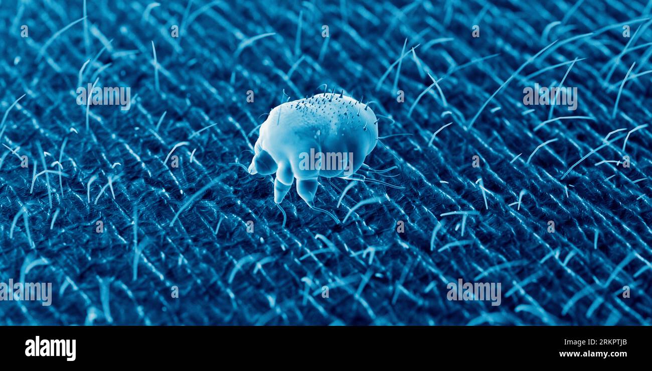 Scabies mite on human skin, illustration Stock Photo - Alamy