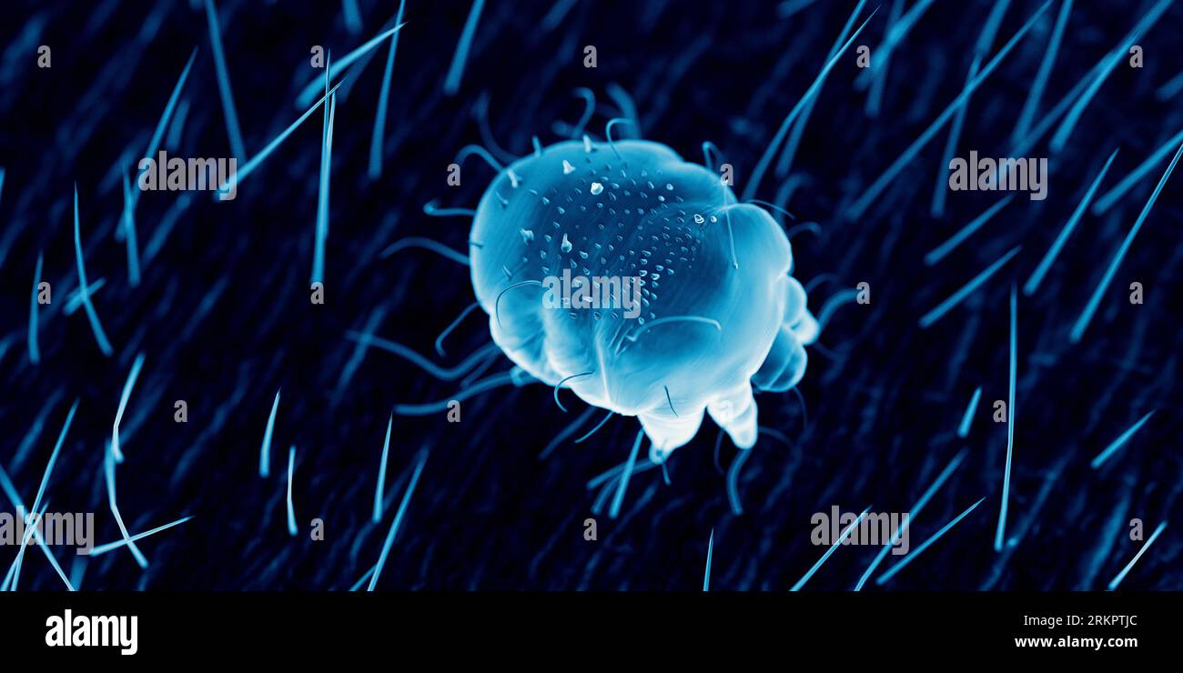 Scabies mite on human skin, illustration Stock Photo - Alamy