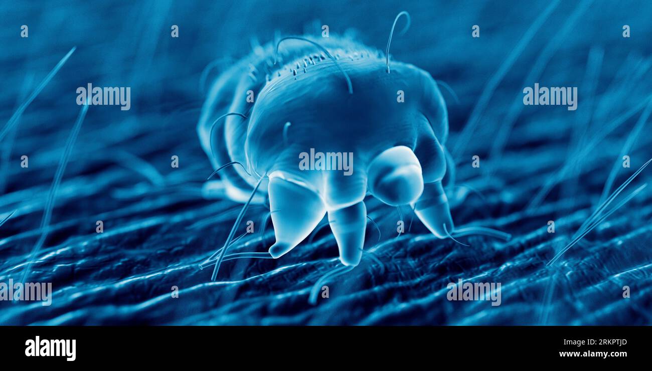 Scabies mite on human skin, illustration Stock Photo - Alamy