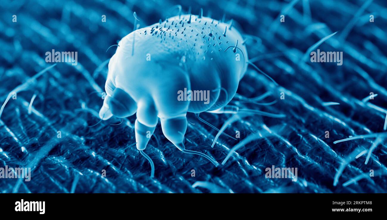 Scabies mite on human skin, illustration Stock Photo - Alamy