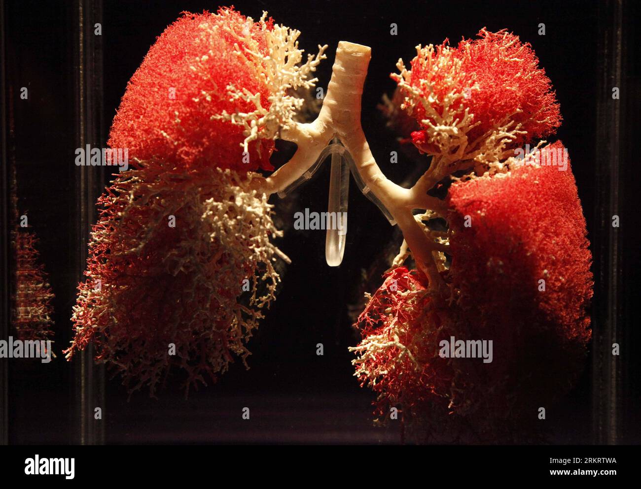 Human body exhibition hi-res stock photography and images - Alamy