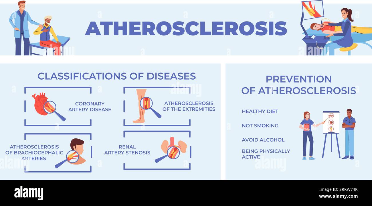 Atherosclerosis artery flat infographic composition with editable text ...