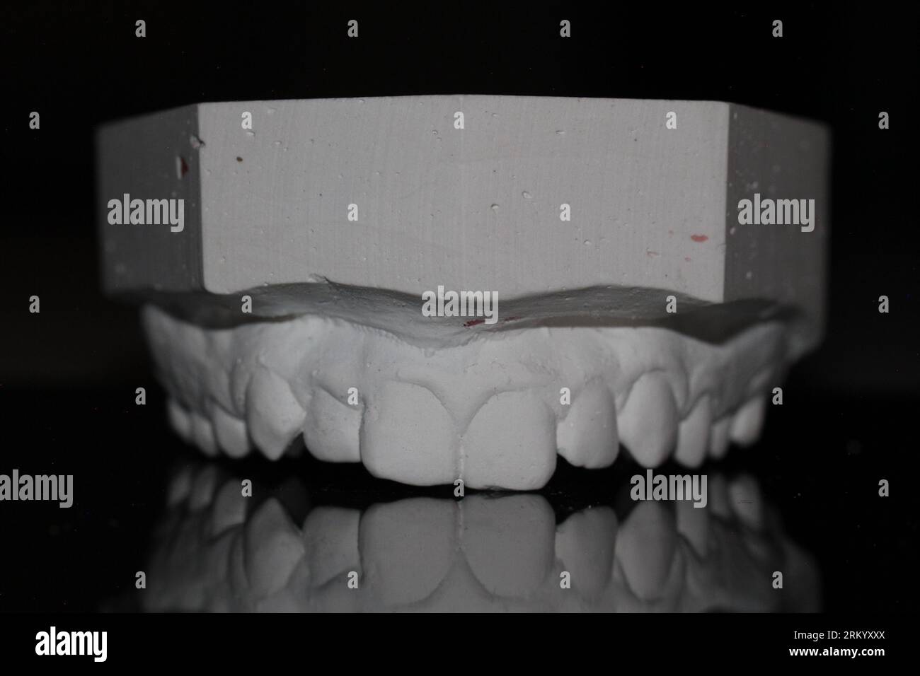 dental technician model orthosis resin wax tooth Stock Photo - Alamy