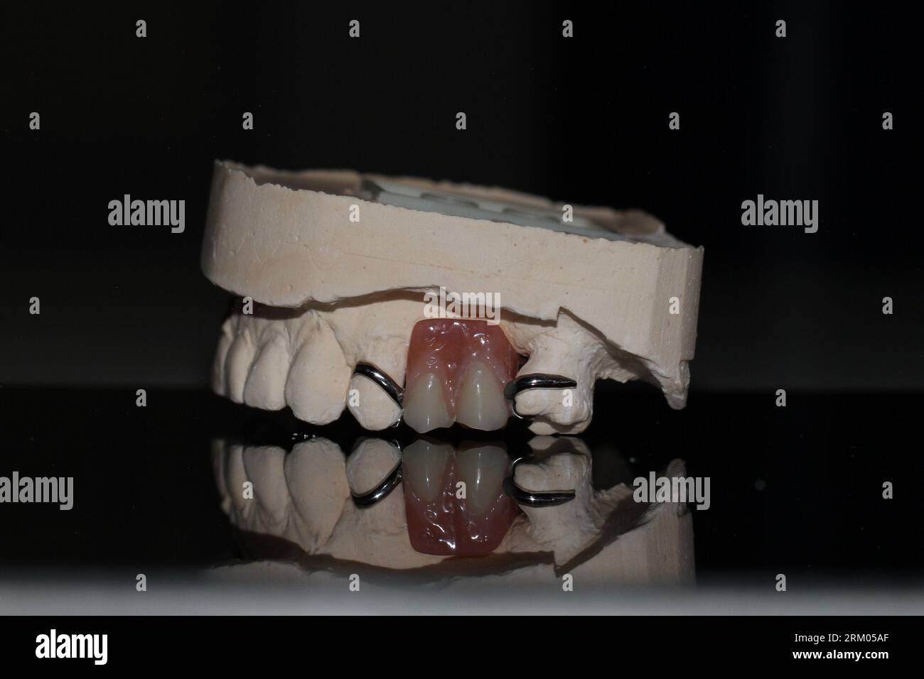 dental technician model removable prosthesis PAPM cobalt chrome resin ...