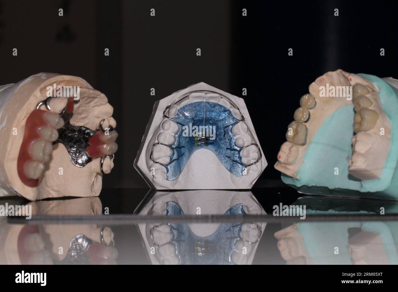 dental technician model orthosis resin wax tooth removable prosthesis ...