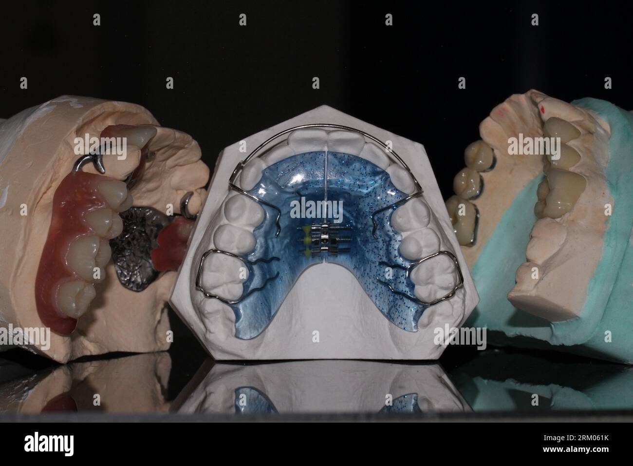 dental technician model orthosis resin wax tooth removable prosthesis ...