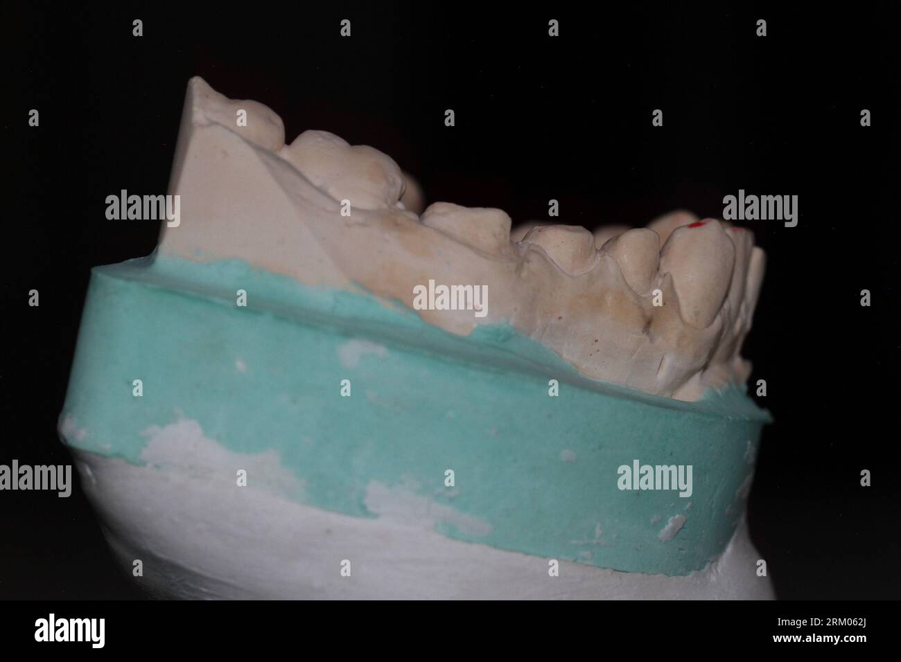 dental technician model fixed prosthesis ceramic wax up plaster crown ...