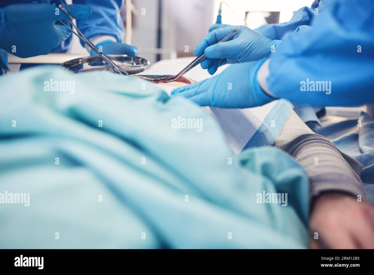 Surgery, group hands and patient operation, hospital emergency service ...