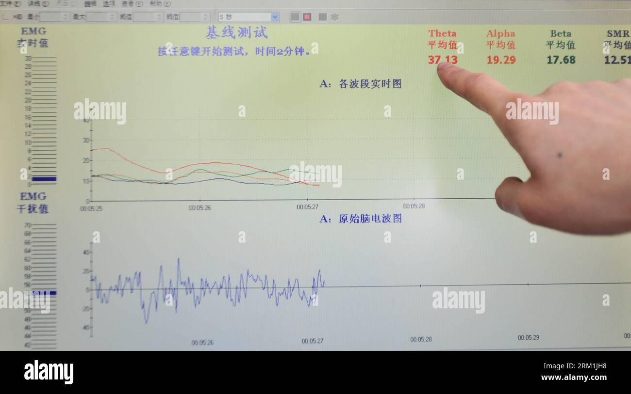 Electroencephalogram eeg hi-res stock photography and images - Alamy