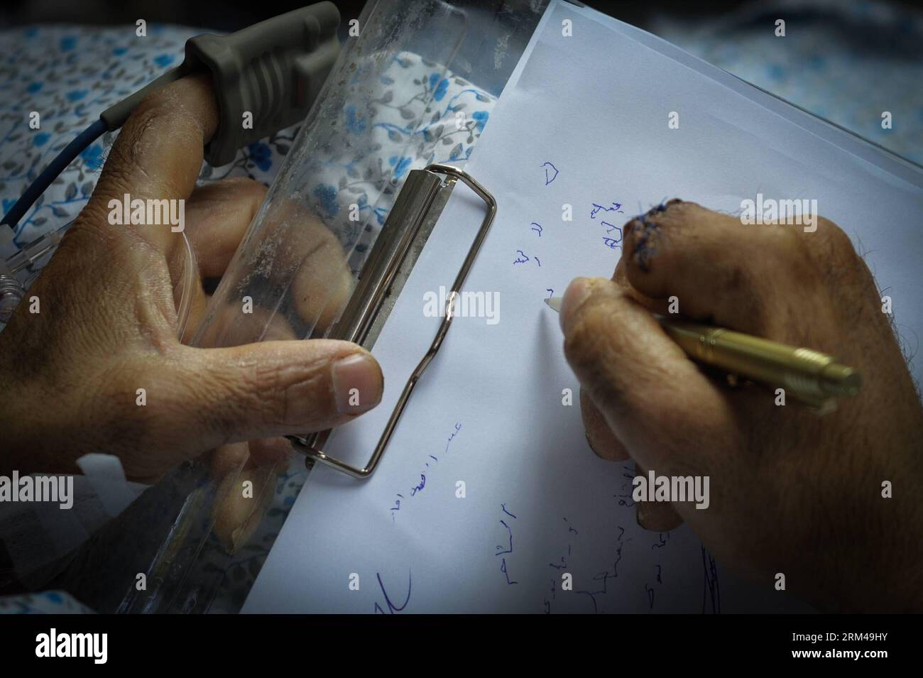Shrapnel wounds hi-res stock photography and images - Alamy