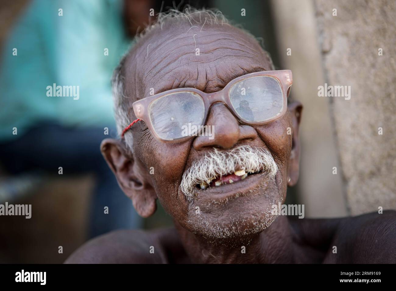 Sunburn india hi-res stock photography and images - Alamy