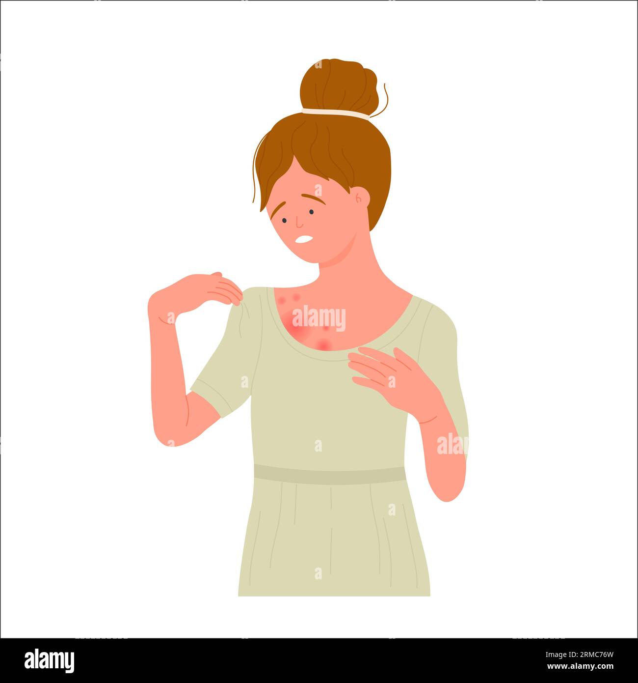 Worried girl with red rash on her body. Allergic itchy reaction, atopic ...