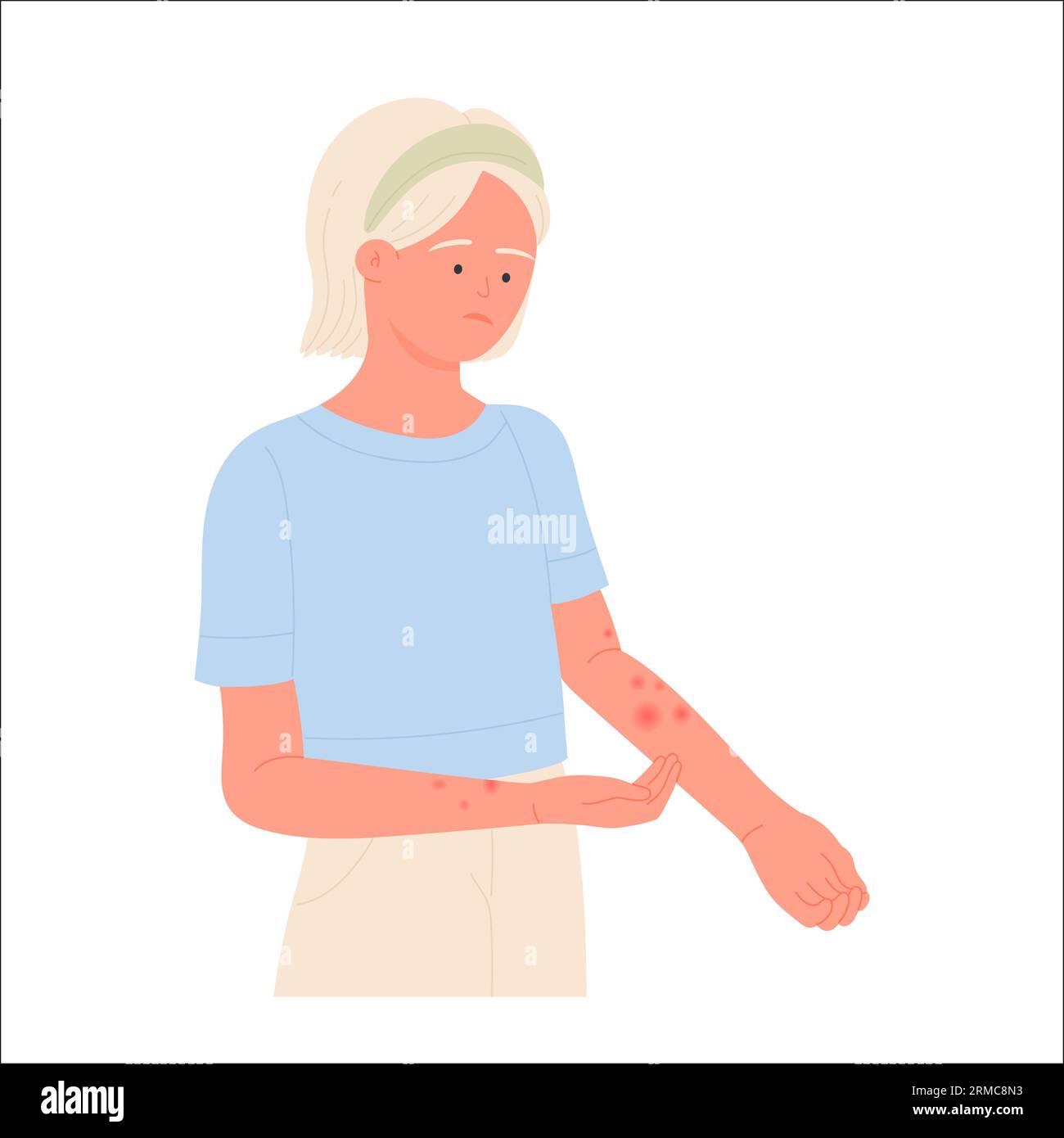 Sad girl with allergy reaction on hands. Itchy skin, red rash on hands ...