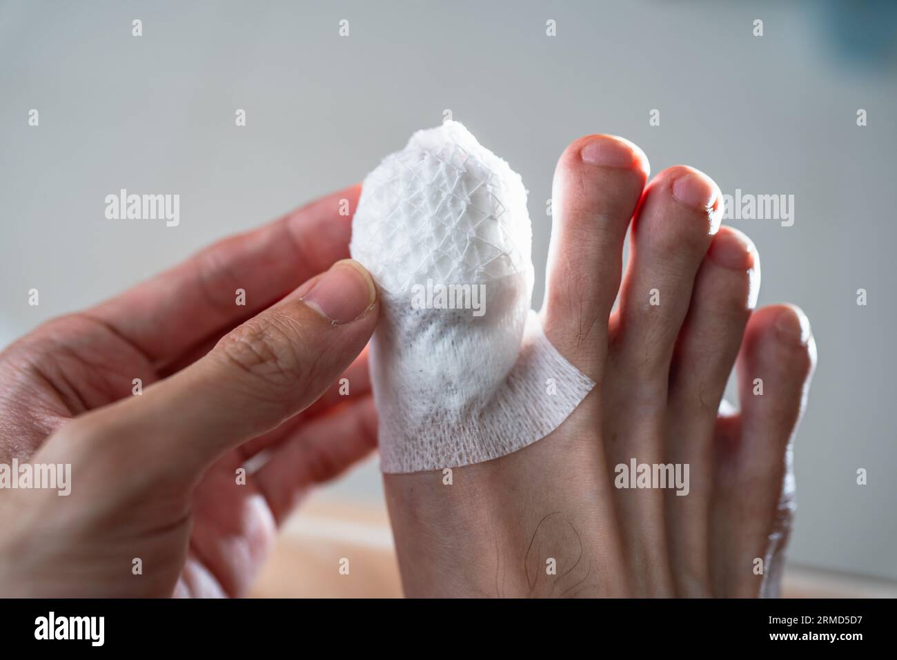 Fixation bandage hi-res stock photography and images - Alamy