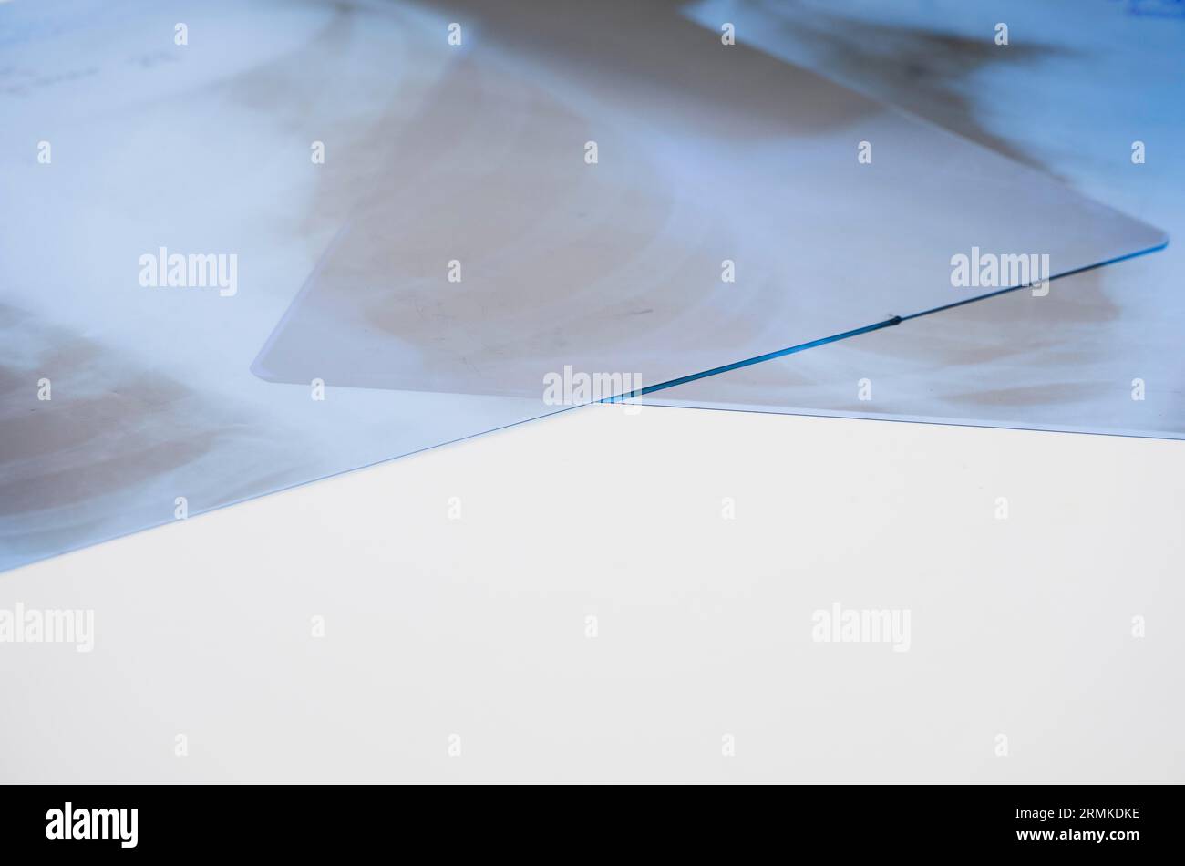 X ray white background Stock Photo - Alamy