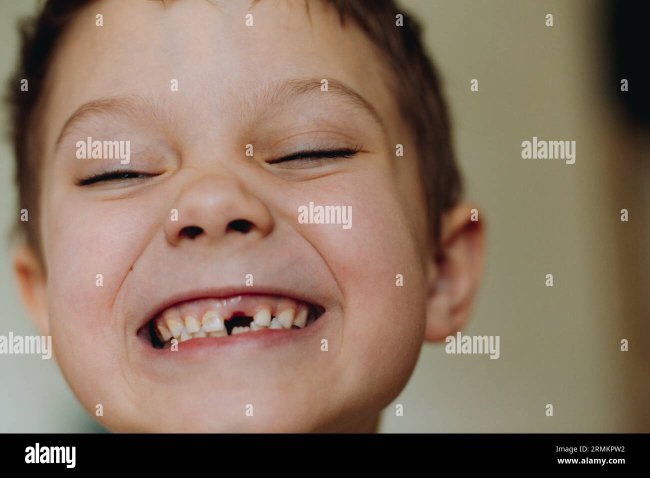 caucasian 6 year old boy with lost front tooth. High quality photo ...