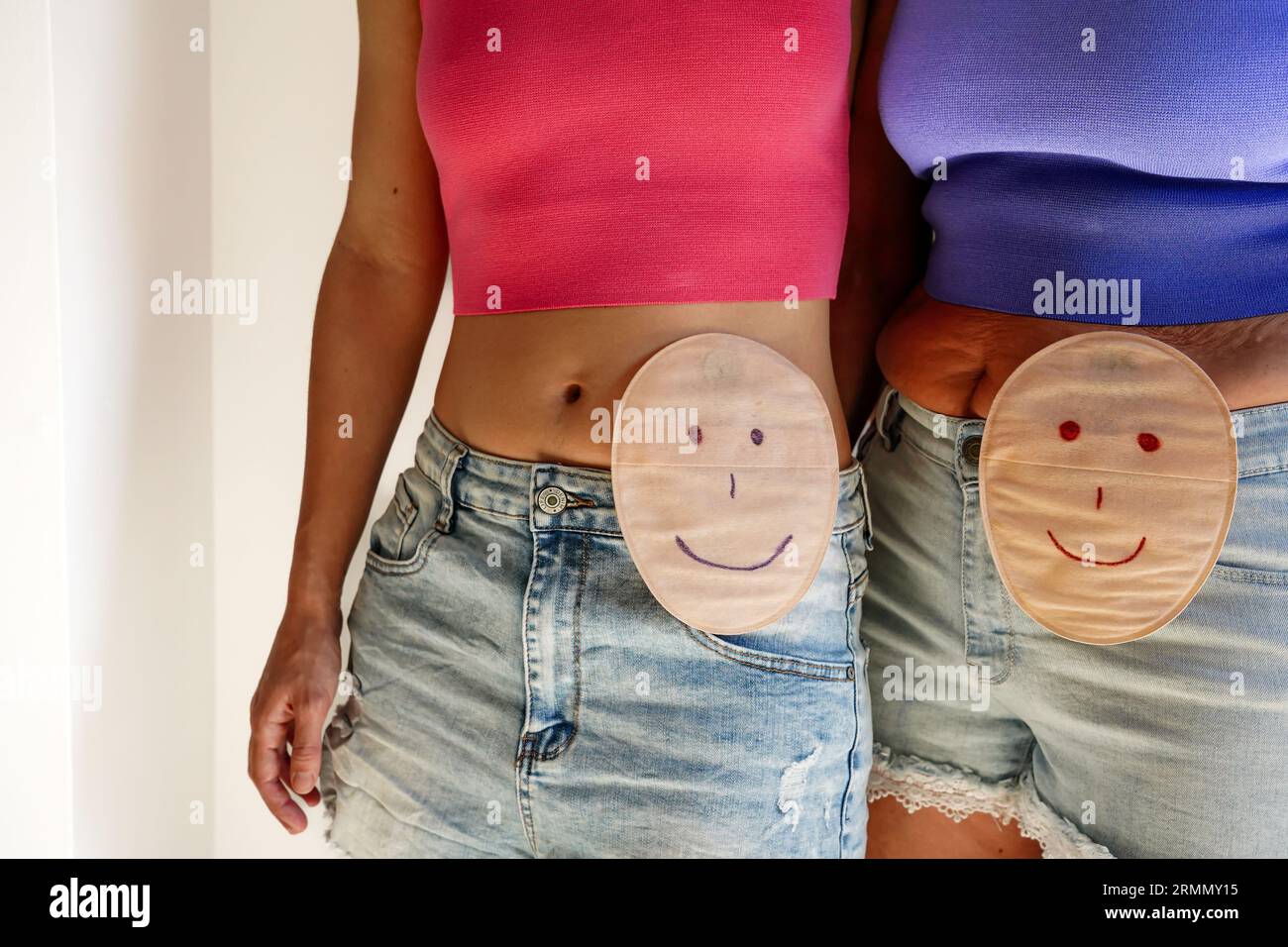 Two unrecognizable women with smiling face in colostomy bag. Couple ...