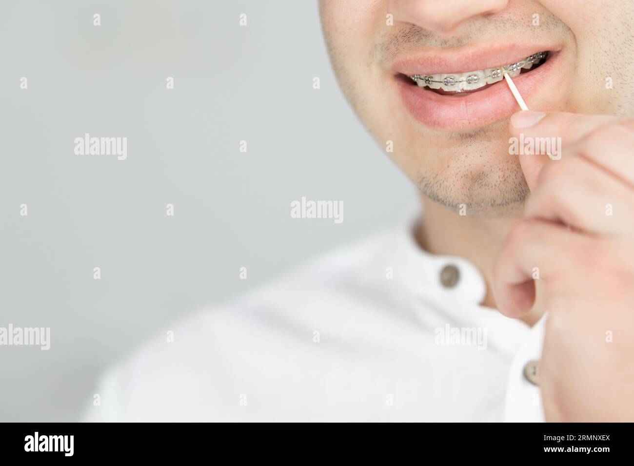 Teeth braces boy hi-res stock photography and images - Alamy